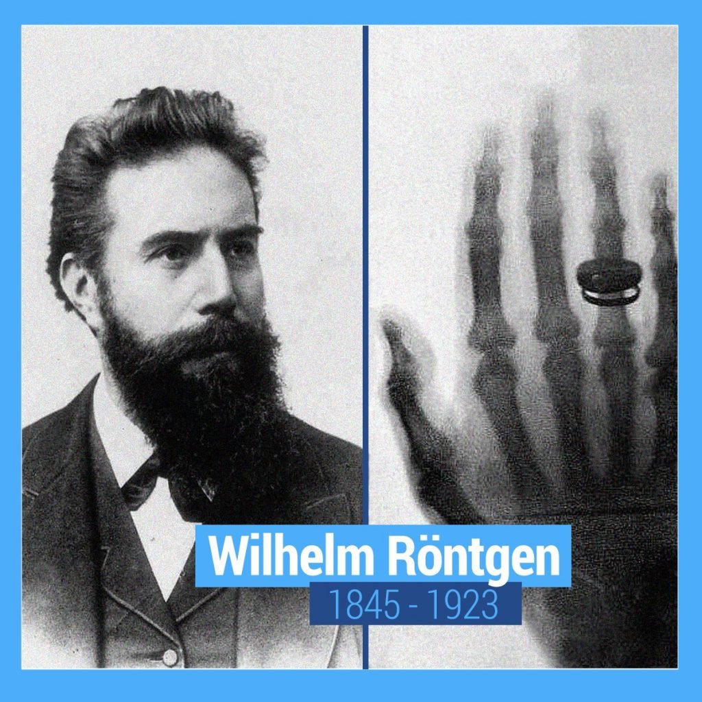 Utilitatea și riscurile imagisticii cu raze X – laMedic.ro